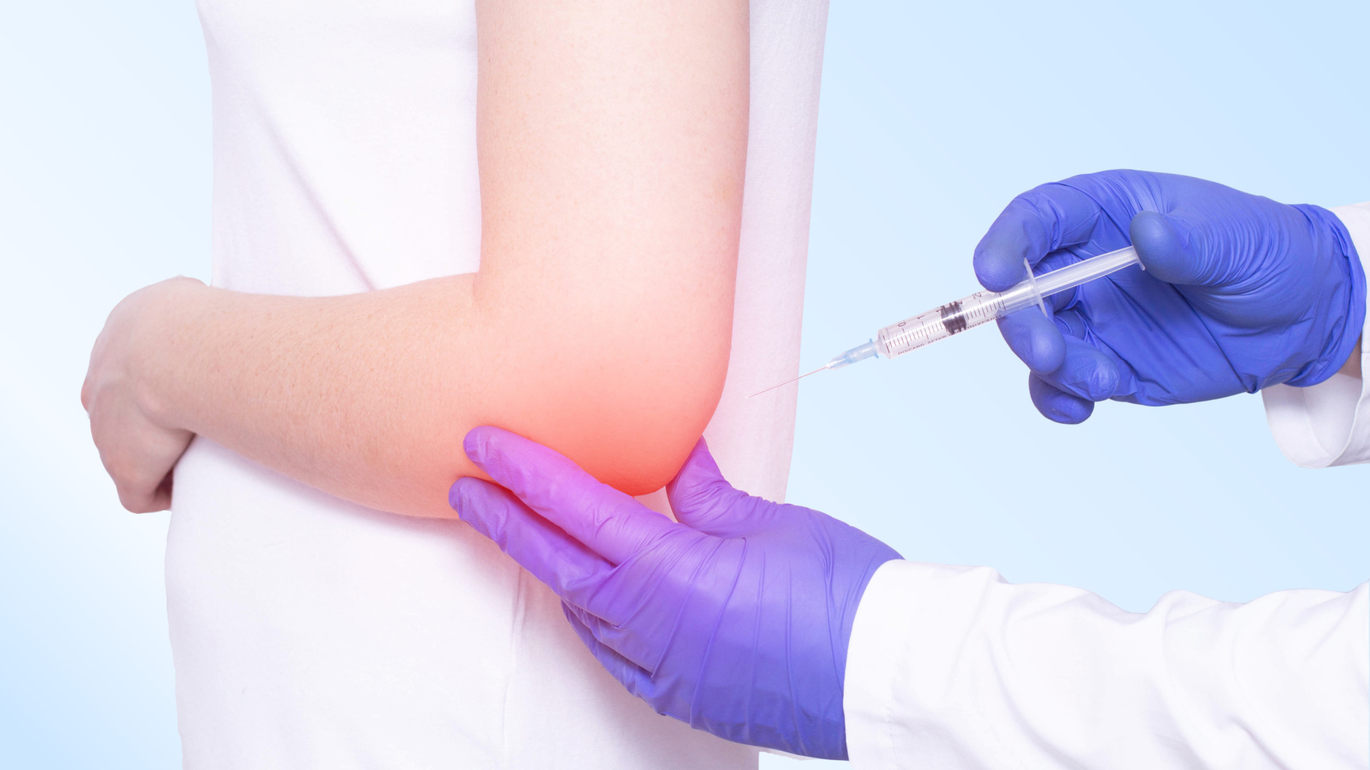 Epicondilitis: Codera para epicondilitis y otro tratamiento